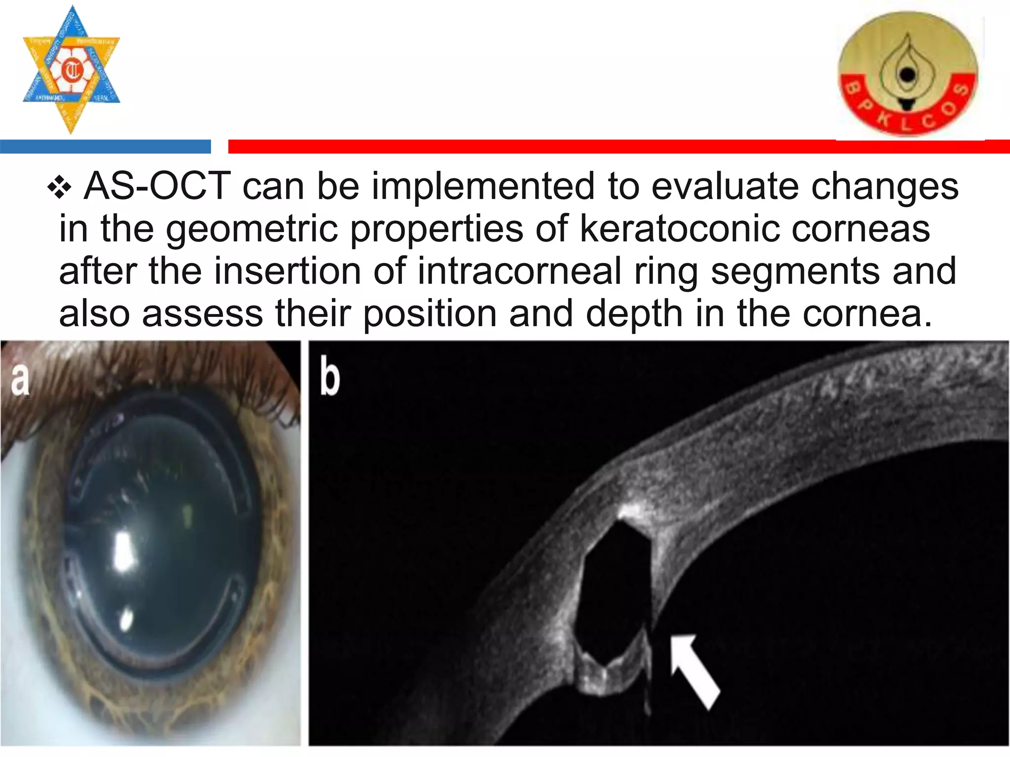 ASOCT NEW SLIDES.pptx