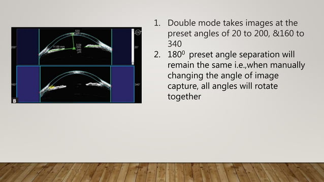 Anterior segment OCT & UBM | PPTX | Eye and Vision Conditions ...