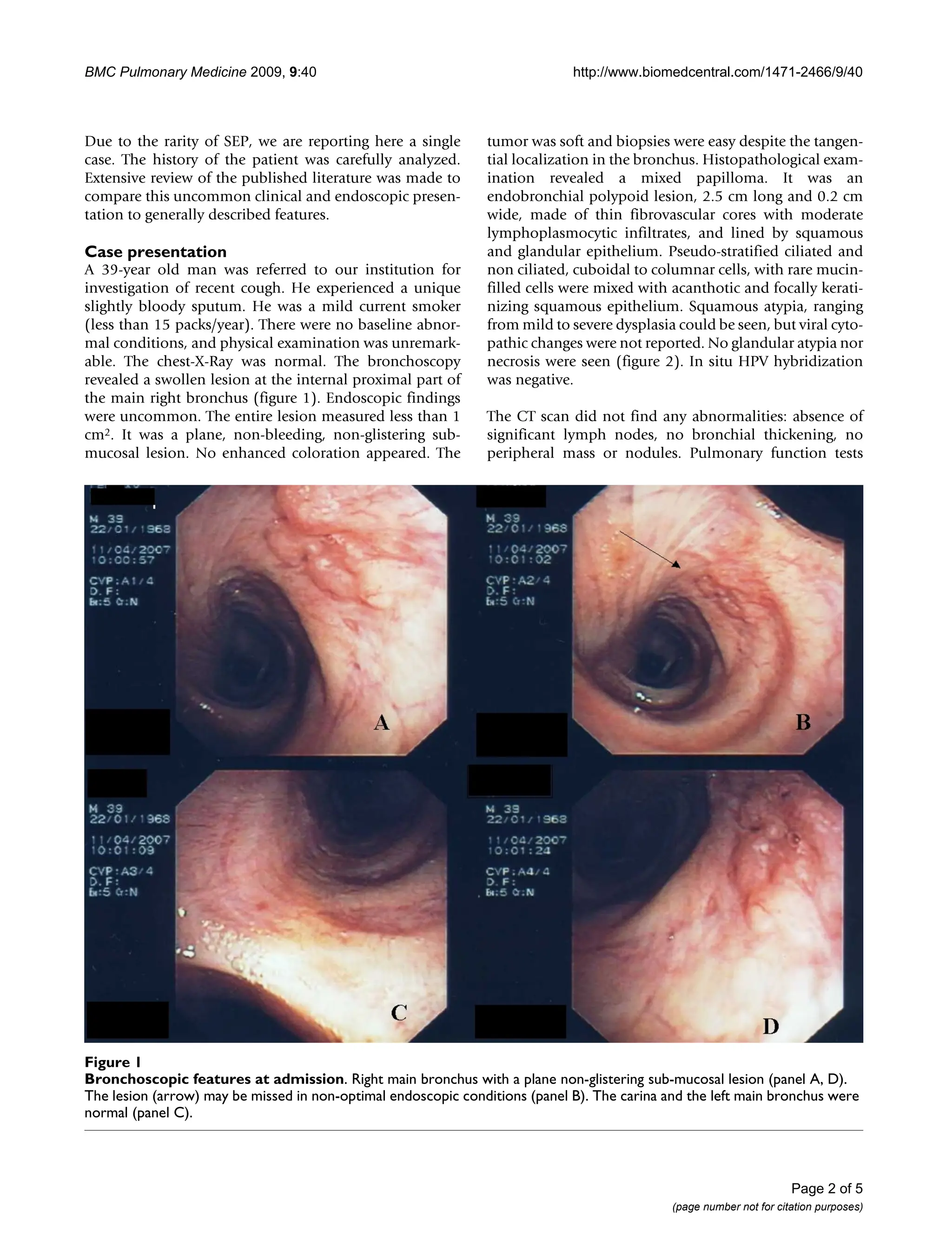 A solitary bronchial papilloma in thorax radiologic finding.pdf