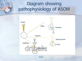 Asom | PDF