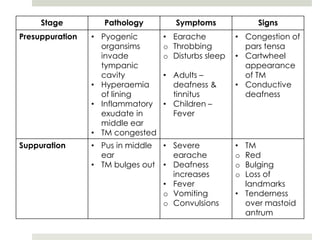 Acute Suppurative Otitis Media | PPTX