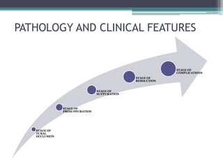 acute suppurative otitis media | PPTX