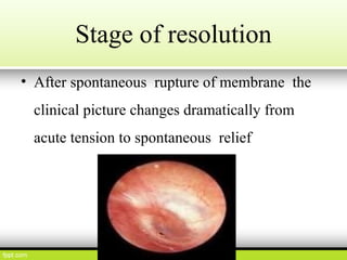 Asom | PPT