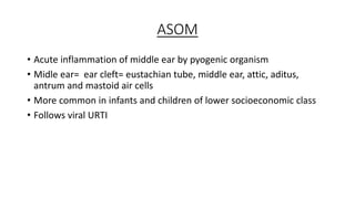 Acute suppurative otitis media | PPTX