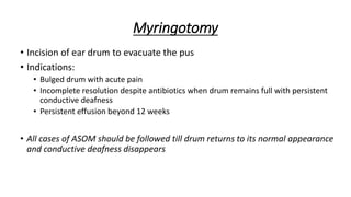Acute suppurative otitis media | PPTX