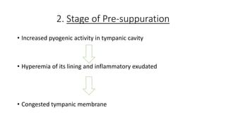 Acute suppurative otitis media | PPTX