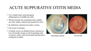 ASOM.pptx acute suppurative otitis media | PPTX