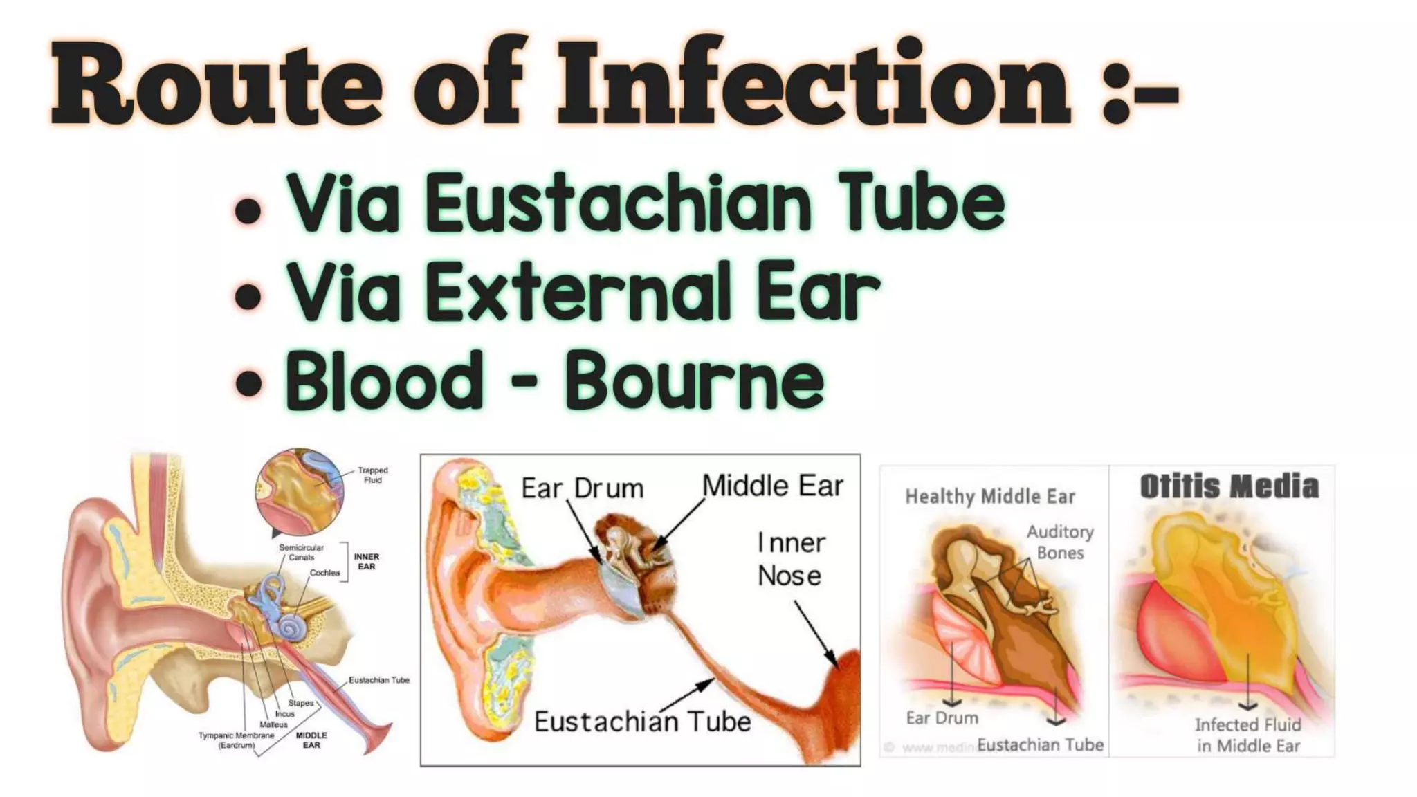 ASOM (Acute Suppurative Otitis Media..).pptx | Ear, Nose and Throat ...
