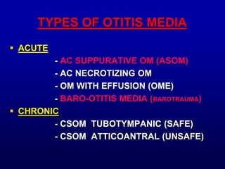 ACUTE SUPPURATIVE OTITIS MEDIA FOR UNDERGRADUATES | PPT