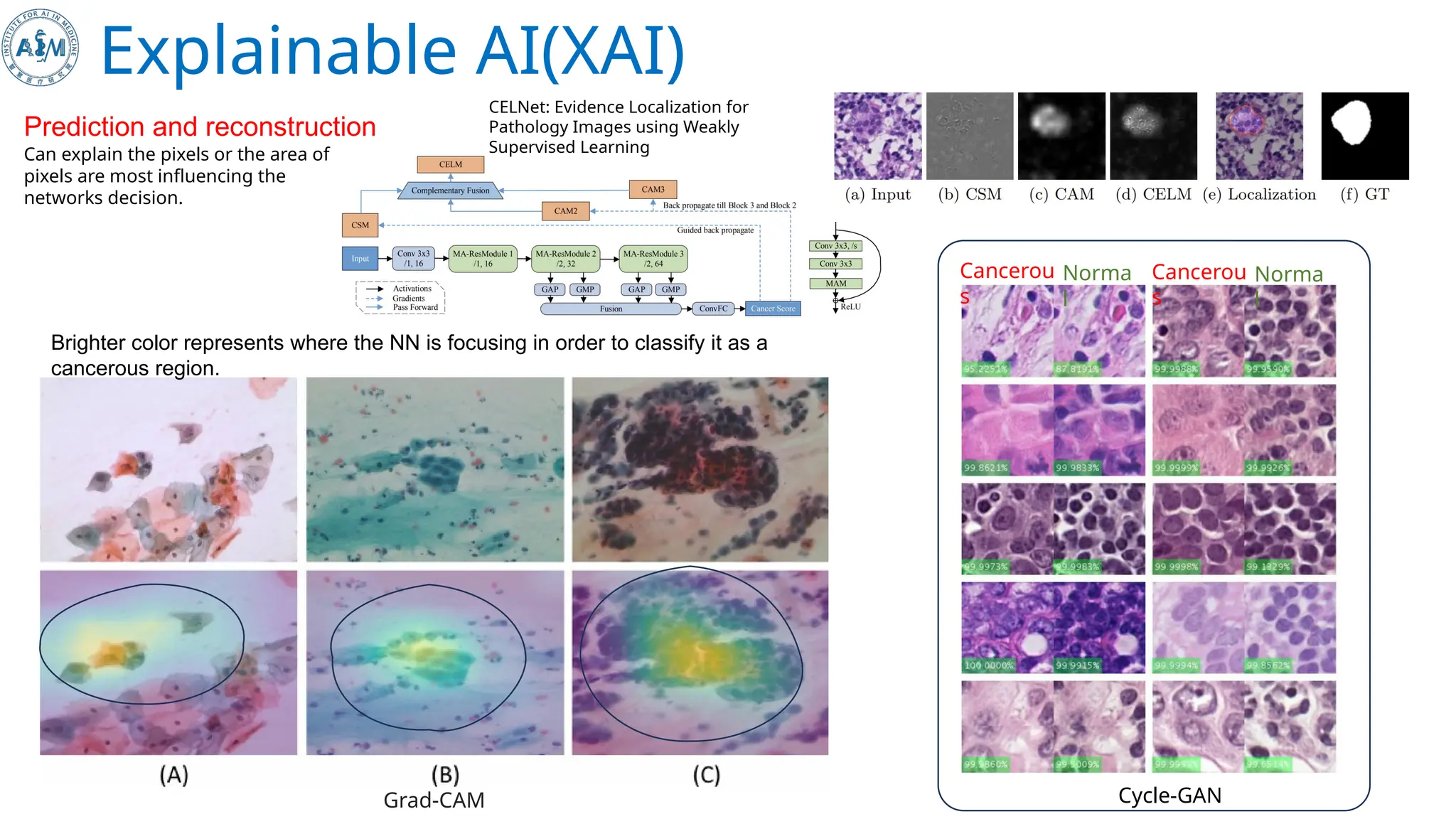 The Importance of explainable AI Digital Pathology.pptx