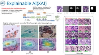 The Importance of explainable AI Digital Pathology.pptx