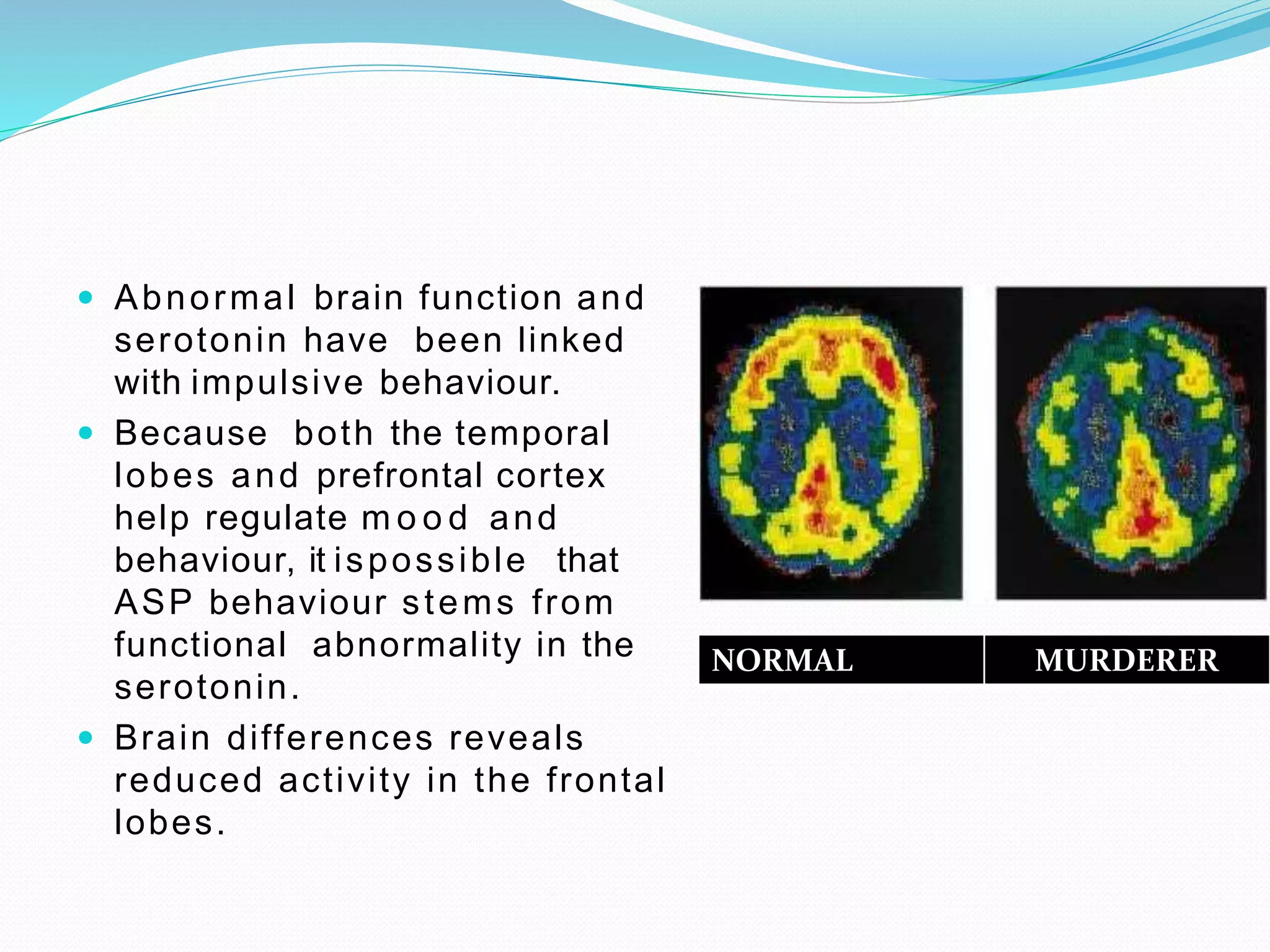 Antisocial Personality Disorder | PPTX