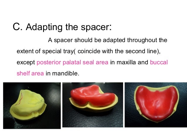 A special tray is defined final
