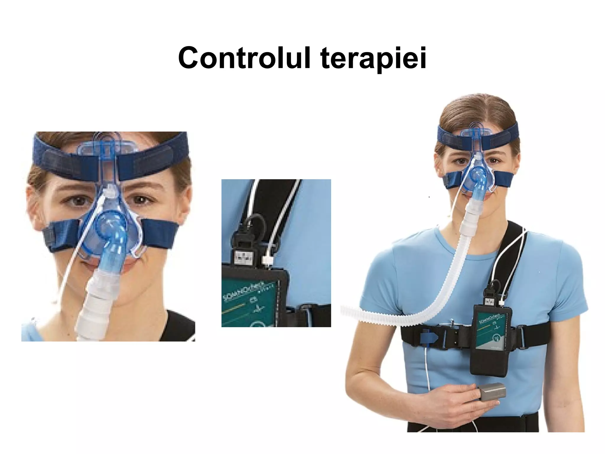 Aspecte practice de polisomnografie si poligrafie | PPT