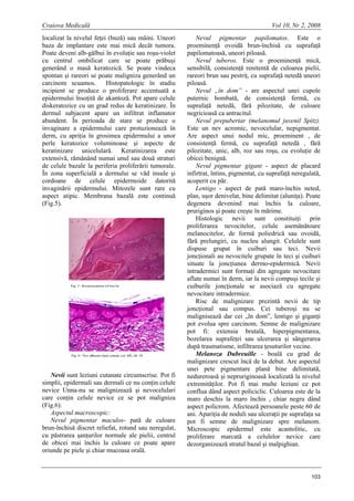 Aspecte precanceroase orale | PDF