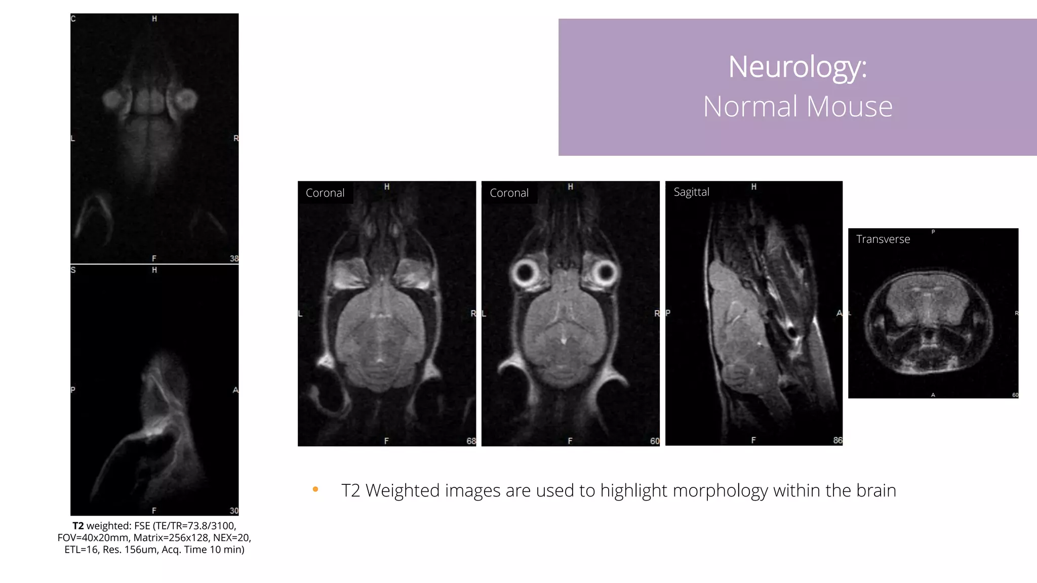 Changing how researchers think about MRI: Utilizing a simple to use ...