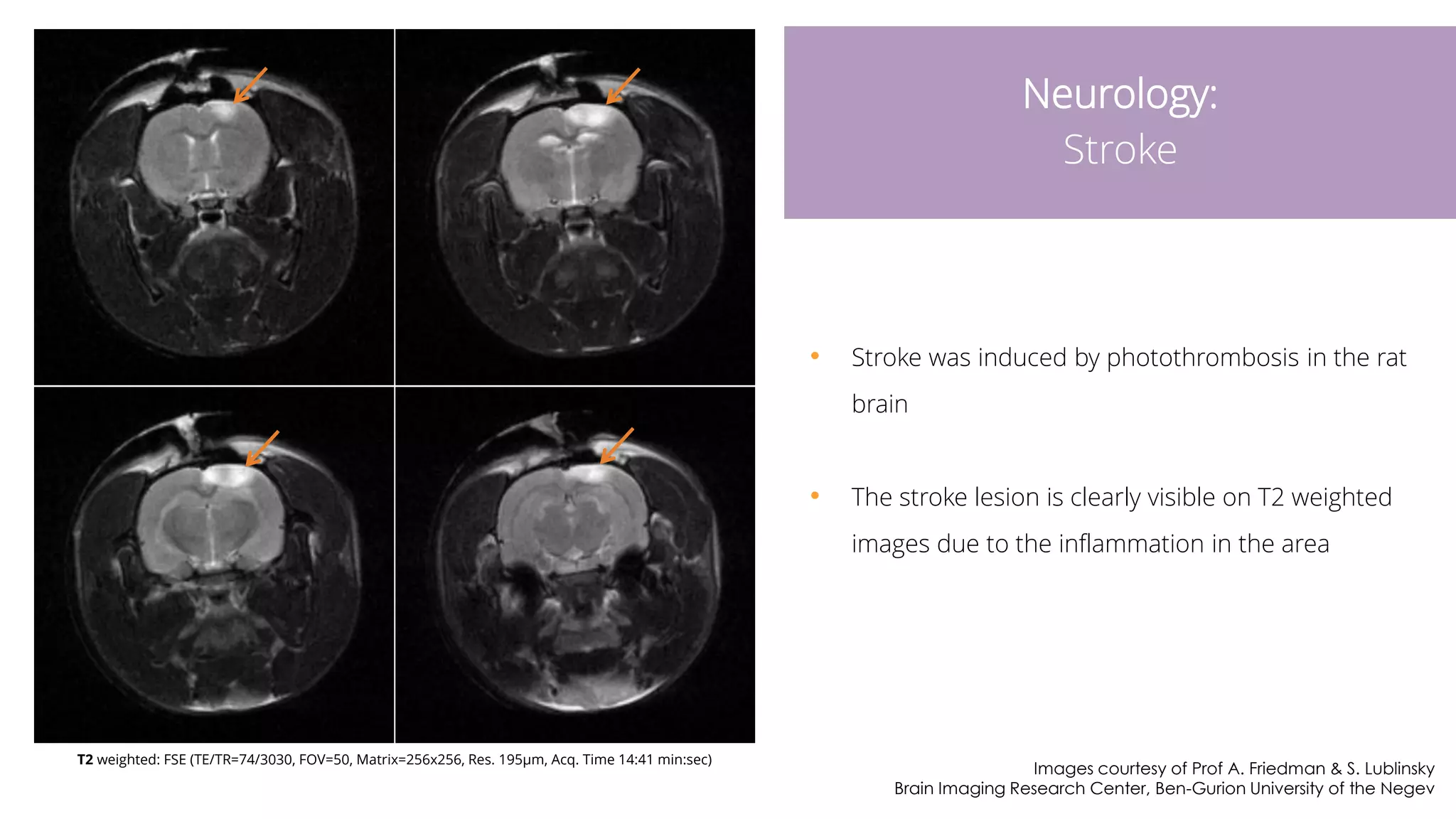 Changing how researchers think about MRI: Utilizing a simple to use ...