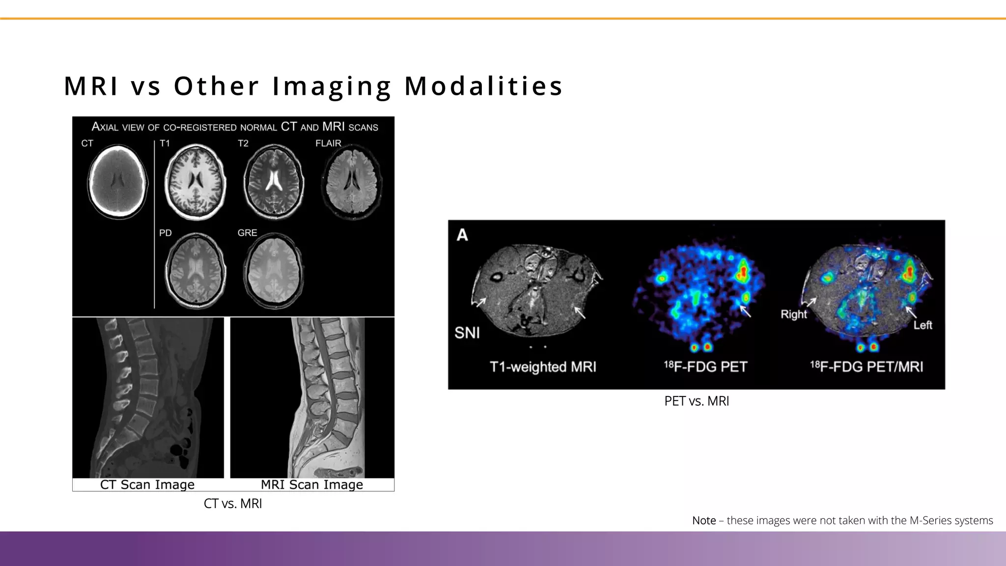 Changing how researchers think about MRI: Utilizing a simple to use ...