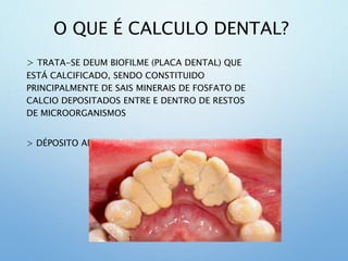 ASPECTOS BIOQUIMICOS DO CALCÚLO DENTARIO.pptx