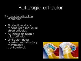 Aspectos Periodontales Y Oclusales En PróTesis Fija | PPT