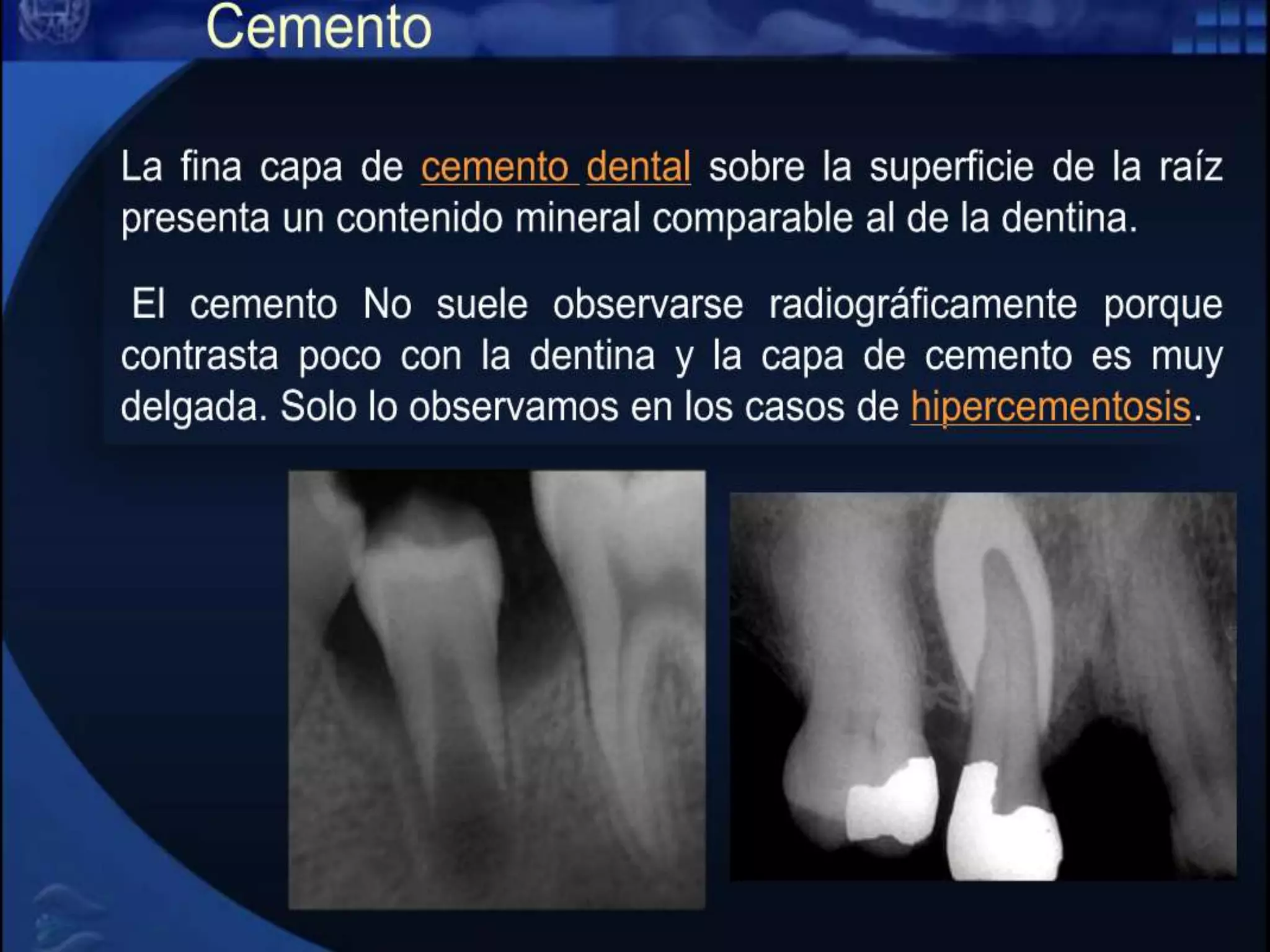 Aspectos radiografico normal (1) | PPT | Free Download