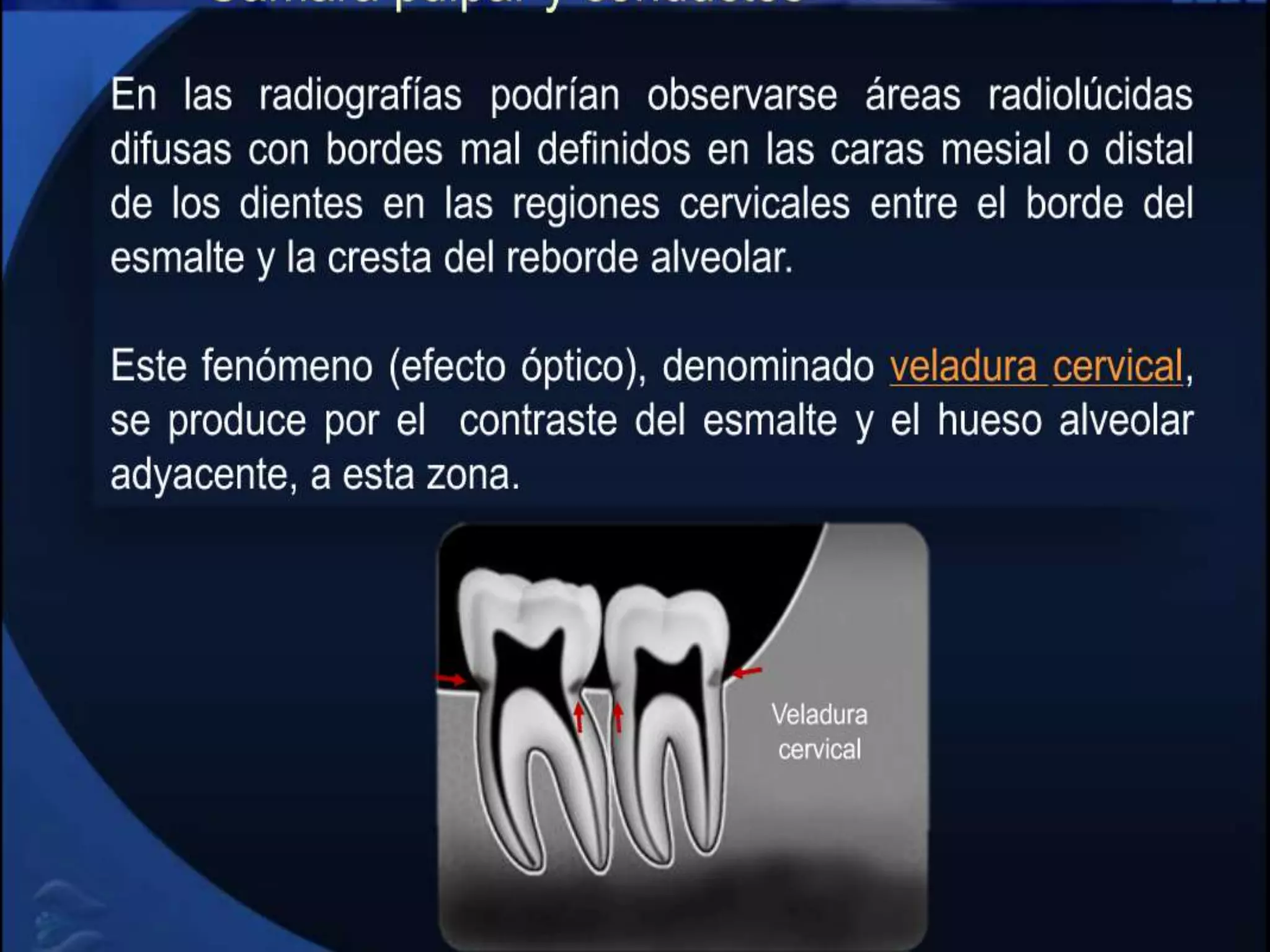 Aspectos radiografico normal (1) | PPT | Free Download