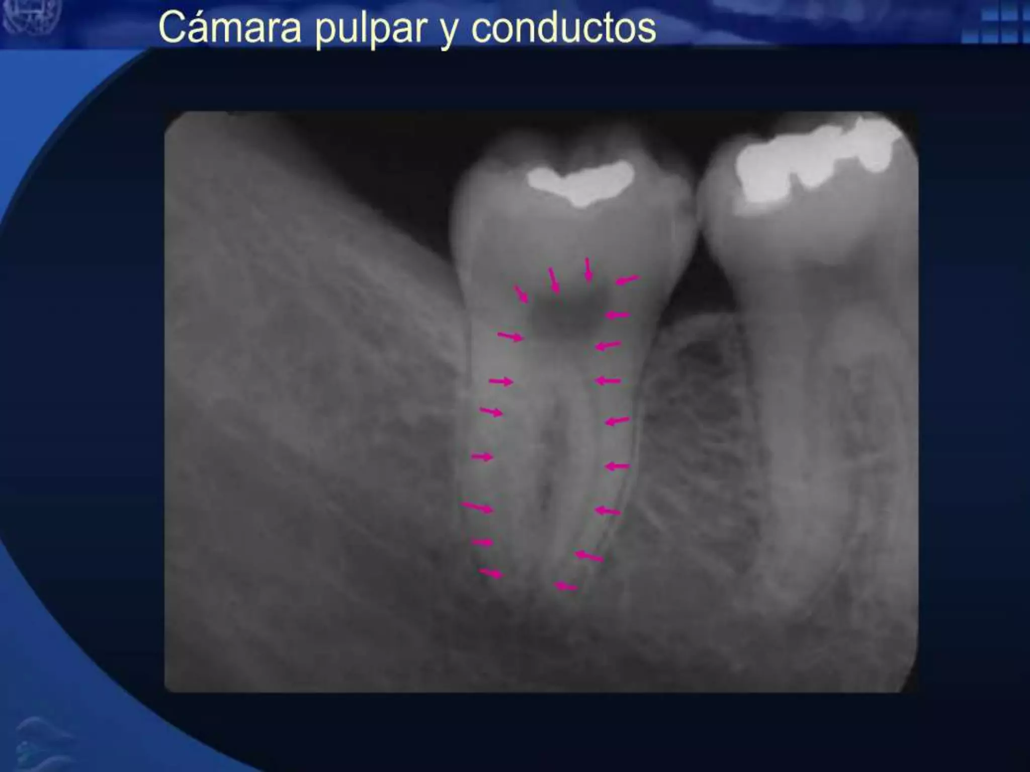 Aspectos radiografico normal (1) | PPT | Free Download