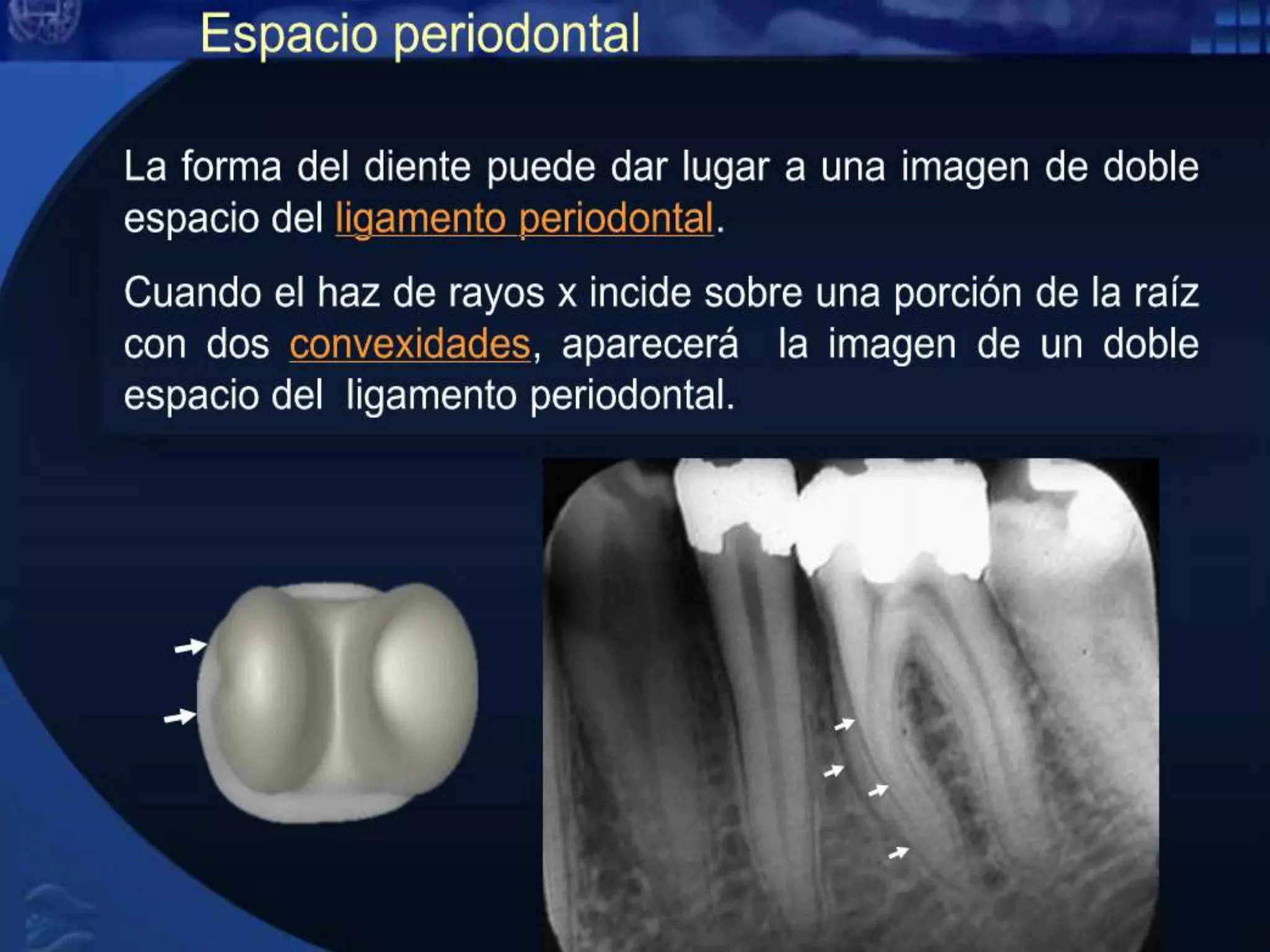 Aspectos radiografico normal (1) | PPT