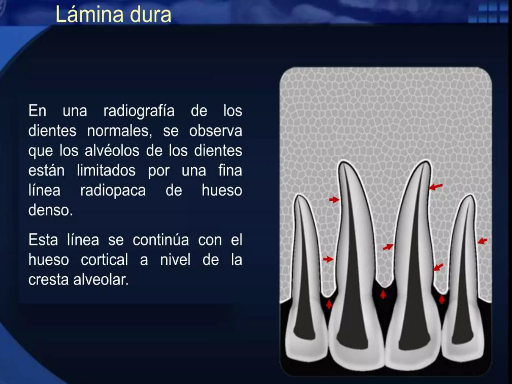 Aspectos radiografico normal (1) | PPT