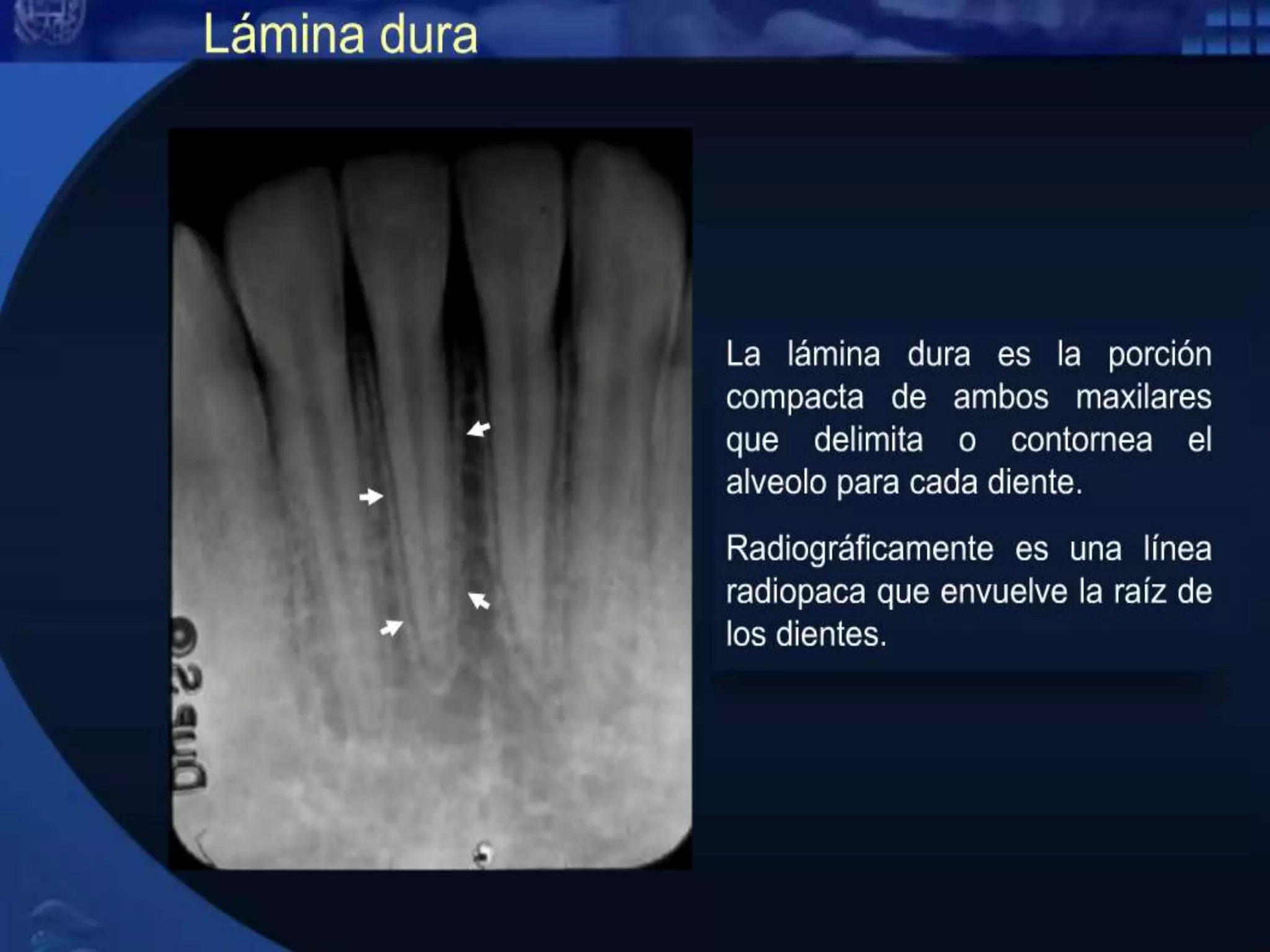Aspectos radiografico normal (1) | PPT