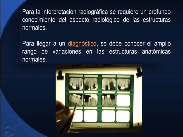 Aspectos radiografico normal (1) | PDF