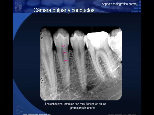 Aspectos radiografico normal (1) | PDF