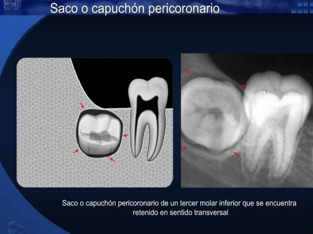 Aspectos radiografico normal (1) | PDF