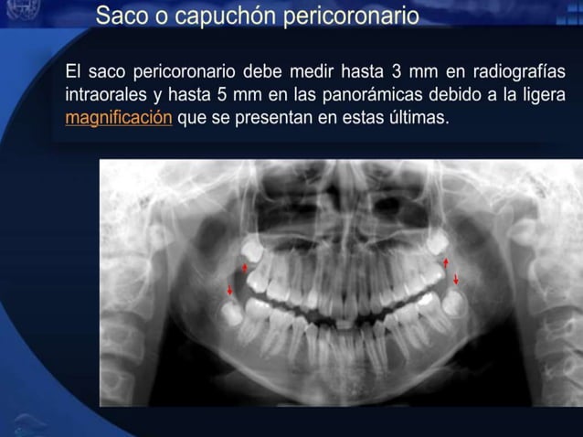Aspectos radiografico normal (1) | PDF