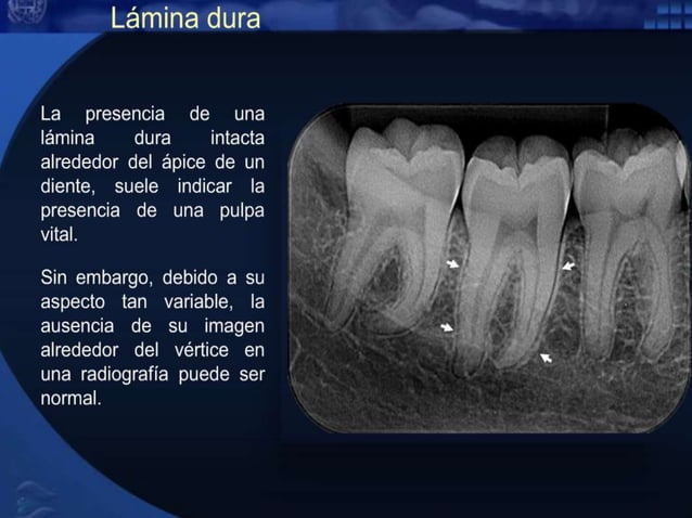 Aspectos radiografico normal (1) | PDF
