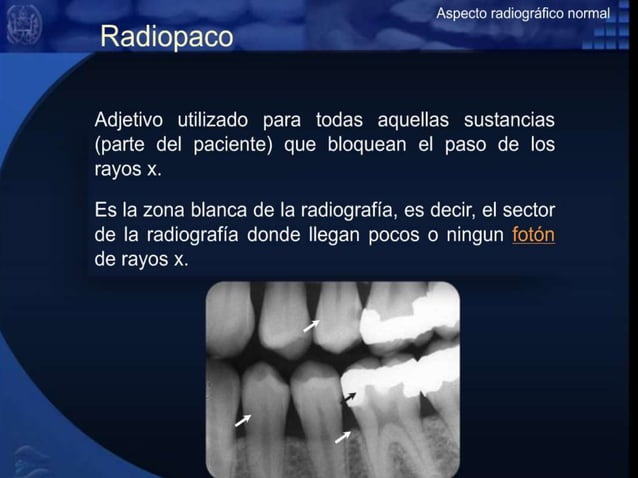 Aspectos radiografico normal (1) | PDF