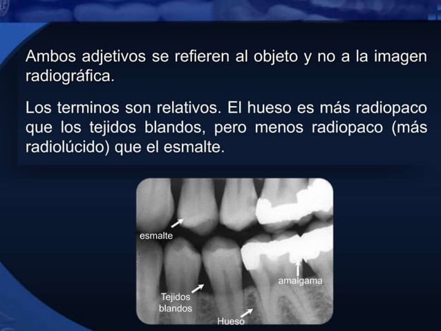 Aspectos radiografico normal (1) | PDF