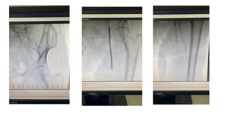 aspek vaskular BTKV Solo.pptx