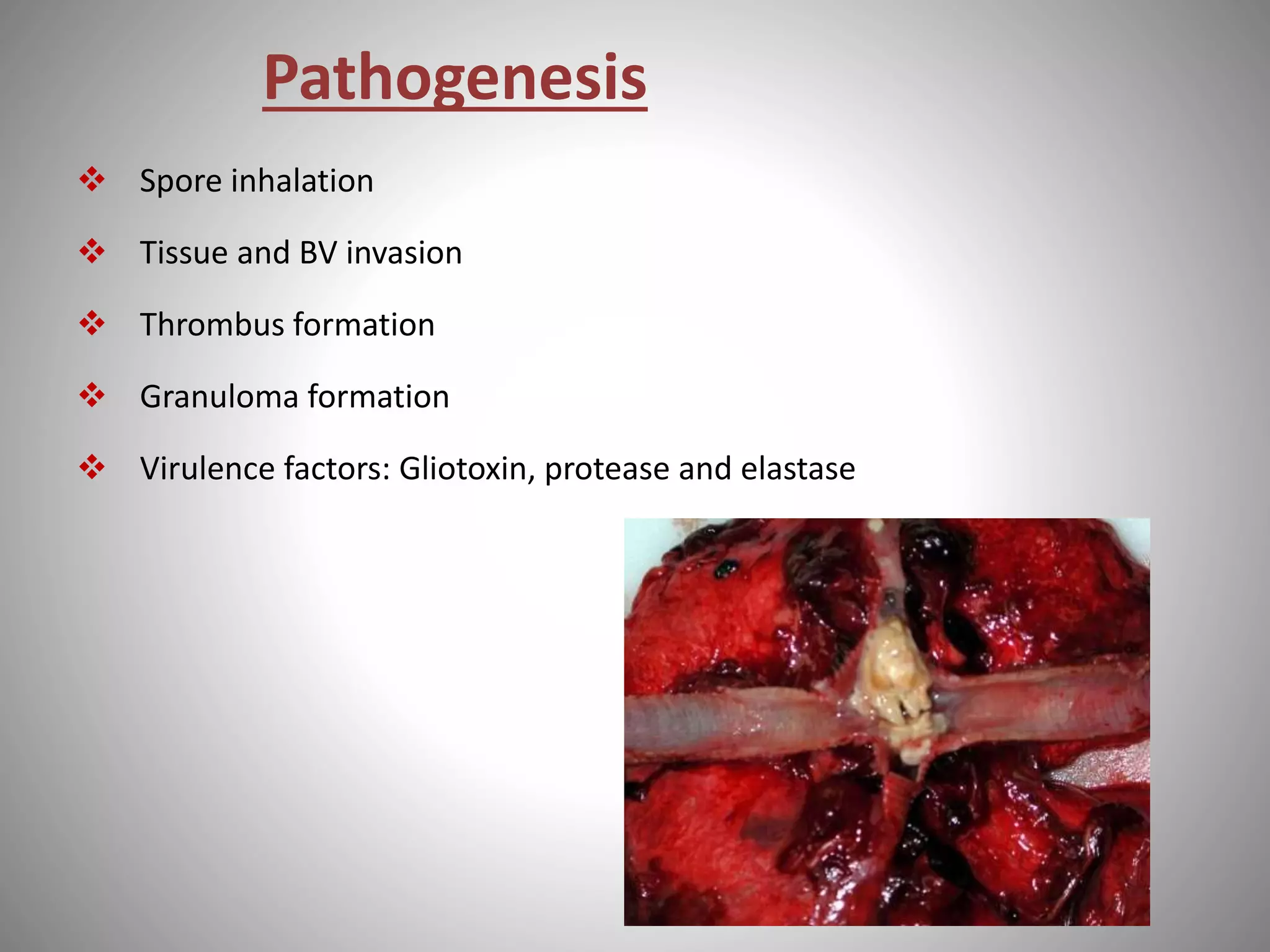 Aspergillosis | PPTX