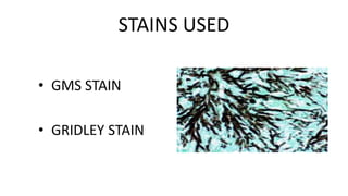 Aspergillosis | PPTX