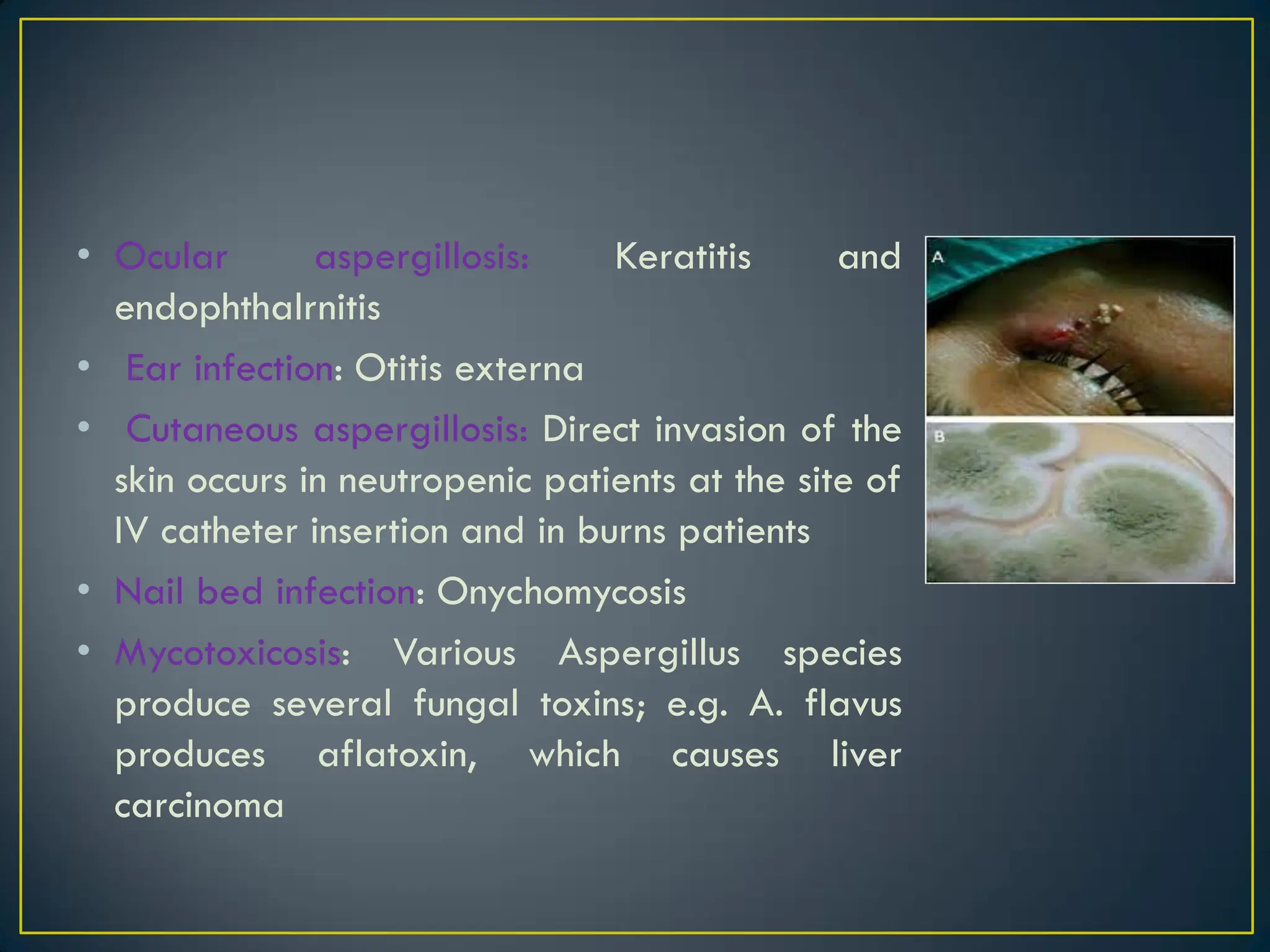 ASPERGILLOSIS.pdf