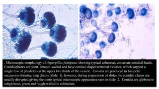 Aspergillosis- Dr. Praveen kumar Doddamani | PPTX