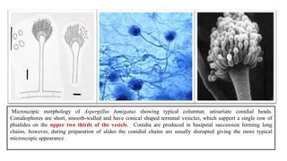 Aspergillosis- Dr. Praveen kumar Doddamani | PPTX