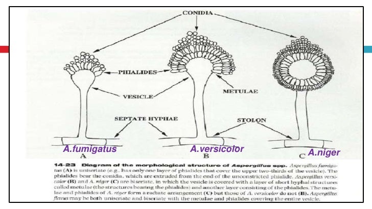 Aspergillosis- Dr. Praveen kumar Doddamani