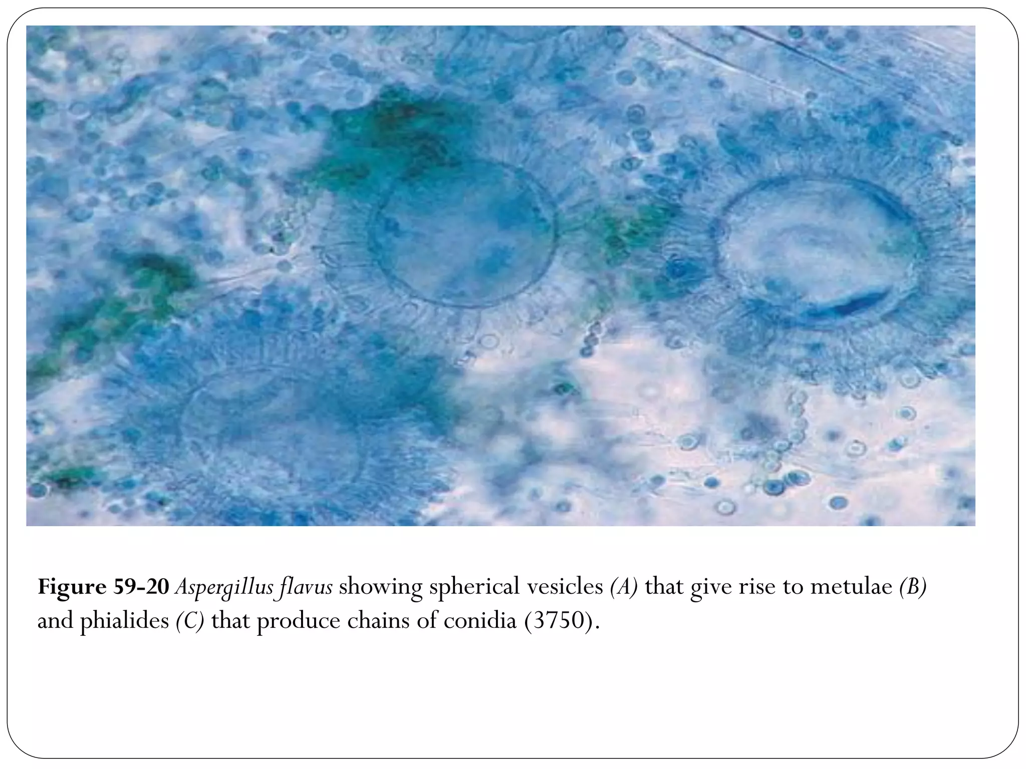Aspergillus | PDF
