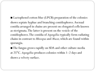 Aspergillus | PDF