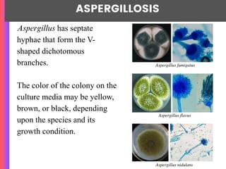Medically Important Aspergillus species.pptx