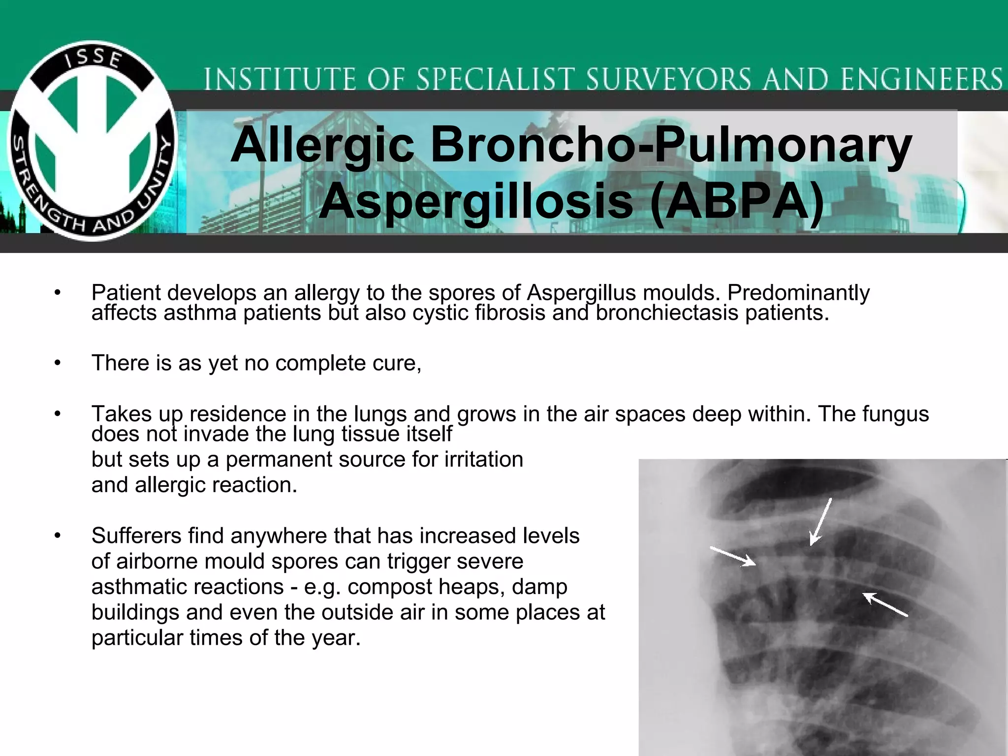 Aspergillus and aspergillosis | PPT