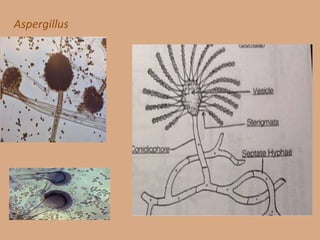 Aspergillus Microscope Label