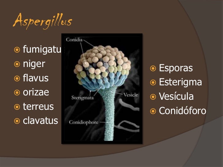 Aspergilosis